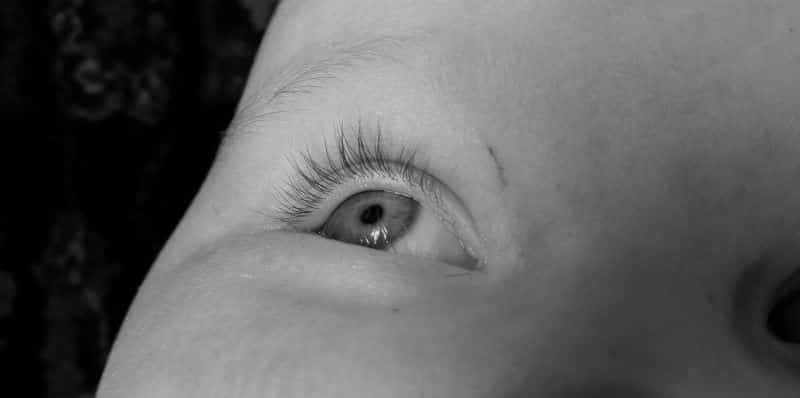 Entropion bij een baby - Nanny Annelon